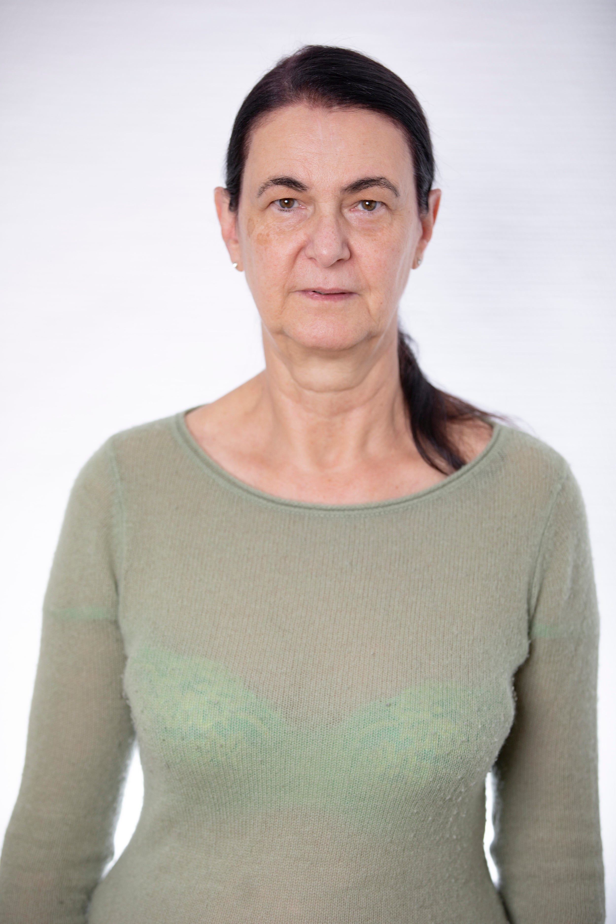 Before And After – Sequoia Skin