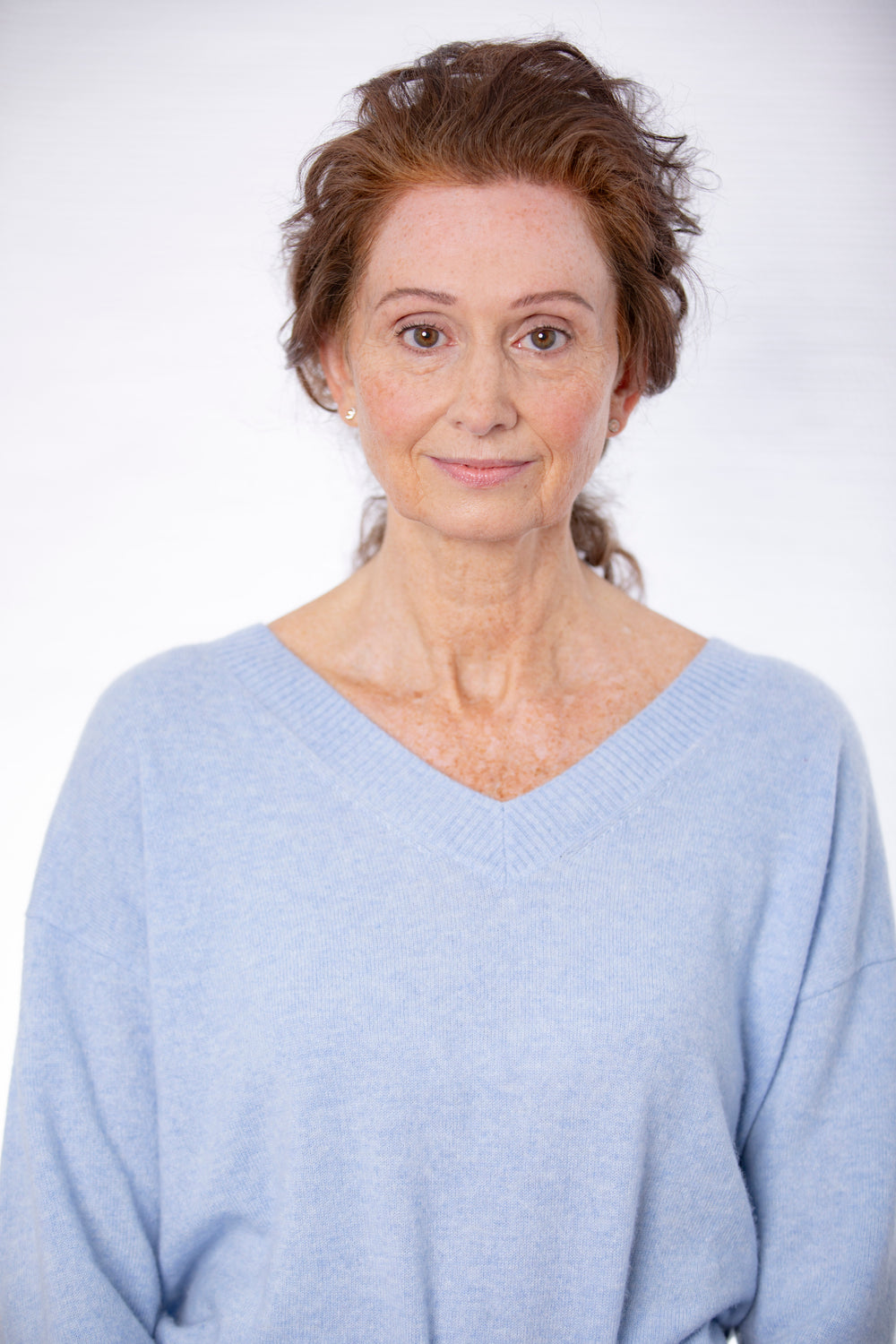 Before And After – Sequoia Skin