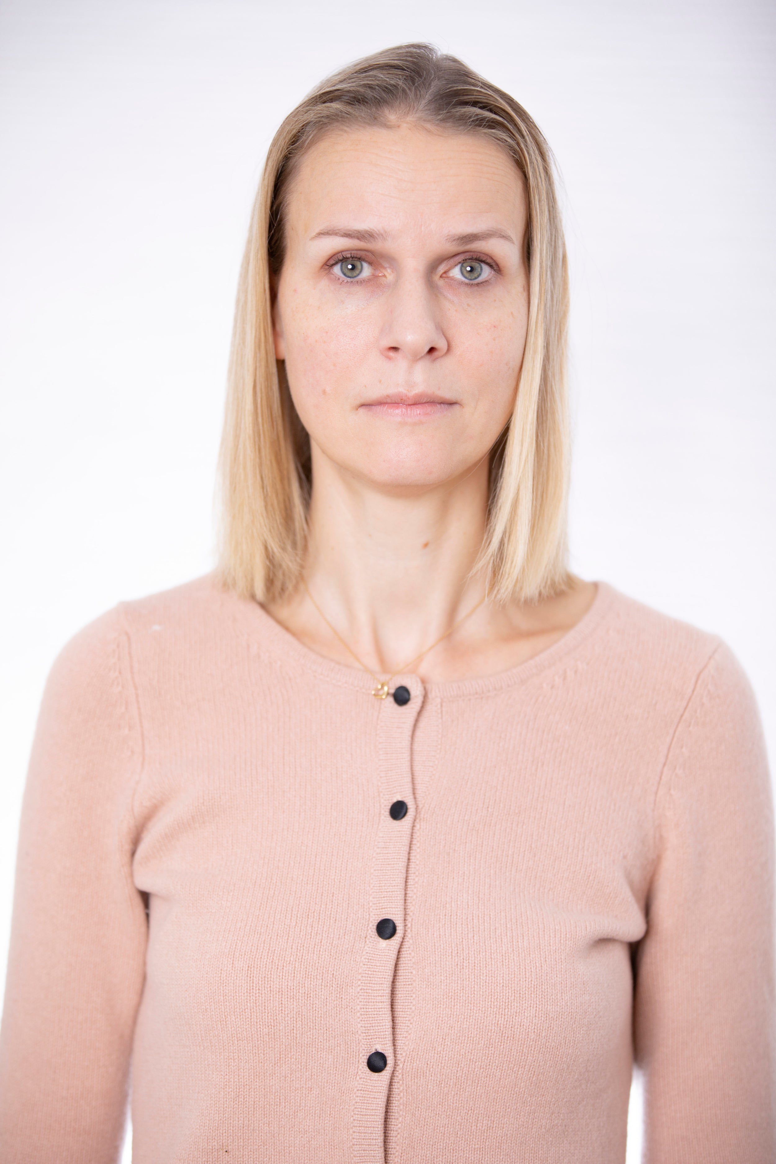 Before And After – Sequoia Skin